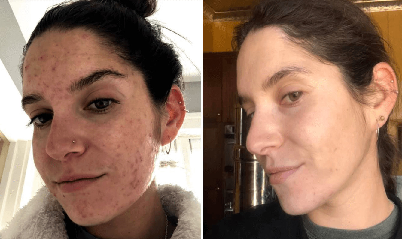 Breakout skincare store