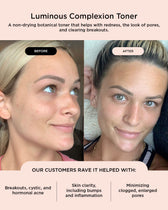 Luminous Complexion Toner - Acne Skin Care Products | Averr Aglow®